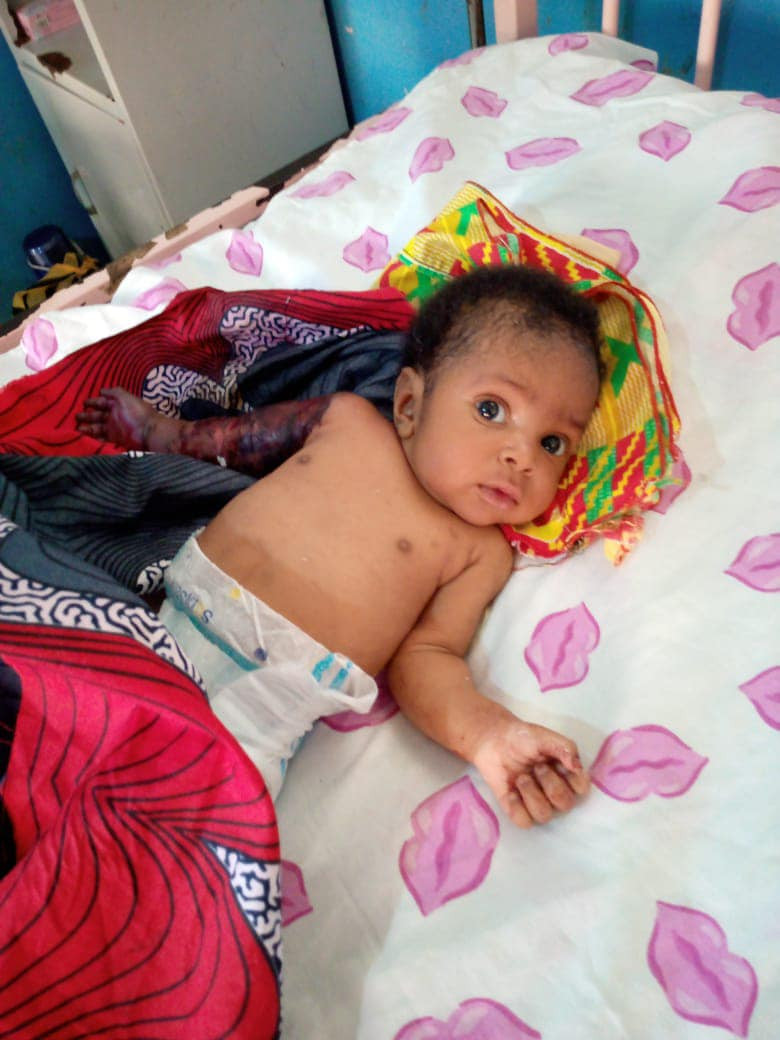 Father breaks the arm of his 2-month-old baby in Imo - Kiddies Africa News